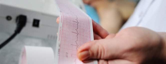 Certified Electrocardiogram Technician (CET) — National Performance ...